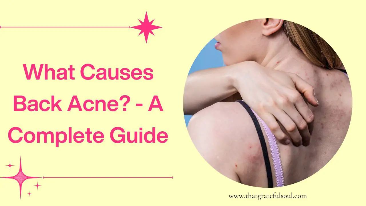 What Causes Back Acne? - A Complete Guide - That Grateful Soul